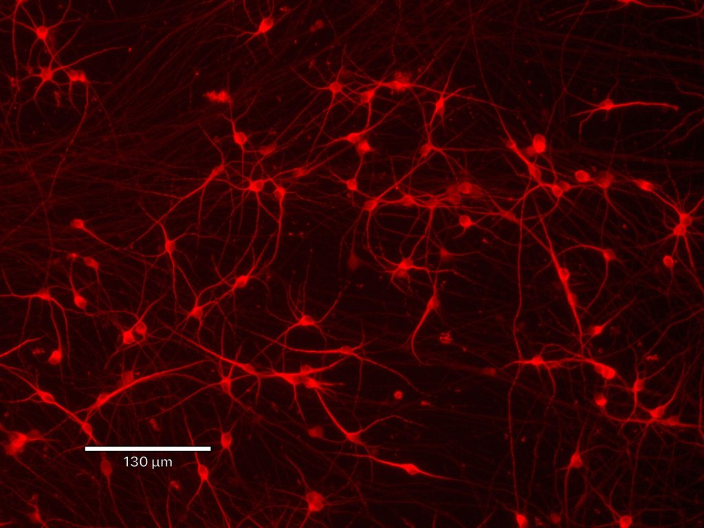 bit.bio introduces first product in groundbreaking ioCRISPR-Ready Cells ...